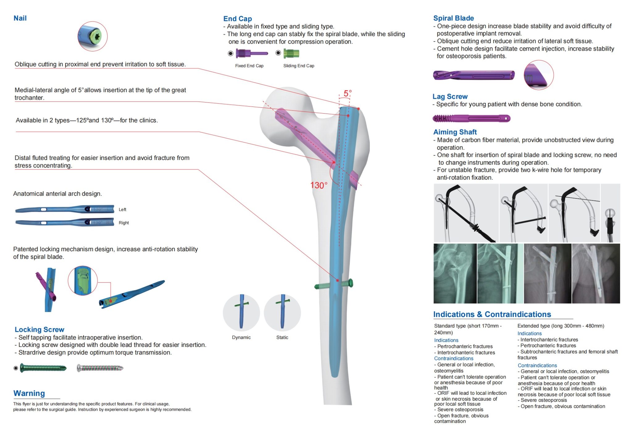 Anatomical Proximal Femoral Nail(APFN) - ctoptec